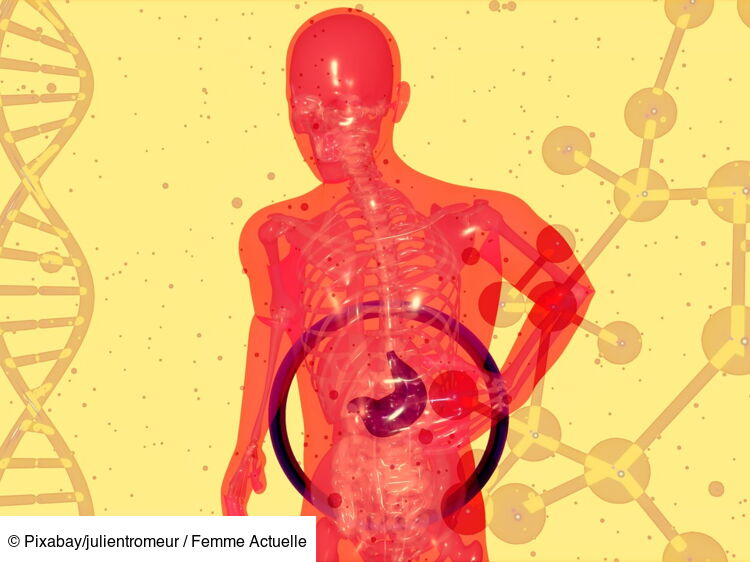 Endobrachyœsophage (EBO) : définition, causes, traitement de l’œsophage ...