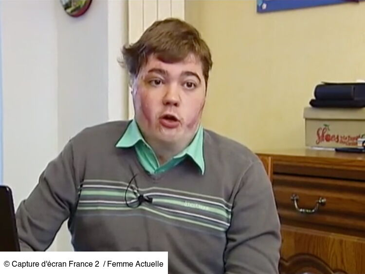 Décès de Jonathan Destin, le jeune homme harcelé dont l’histoire avait ...