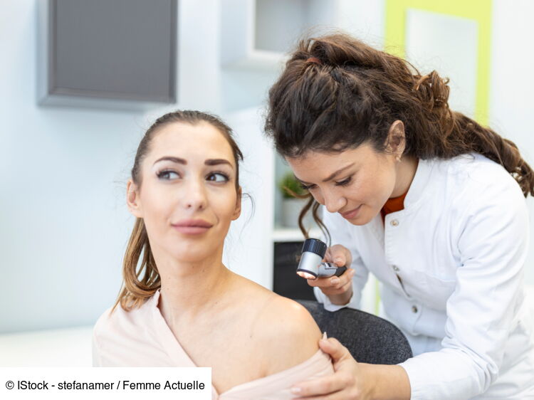 Carcinome basocellulaire : les symptômes et les zones à surveiller pour ...