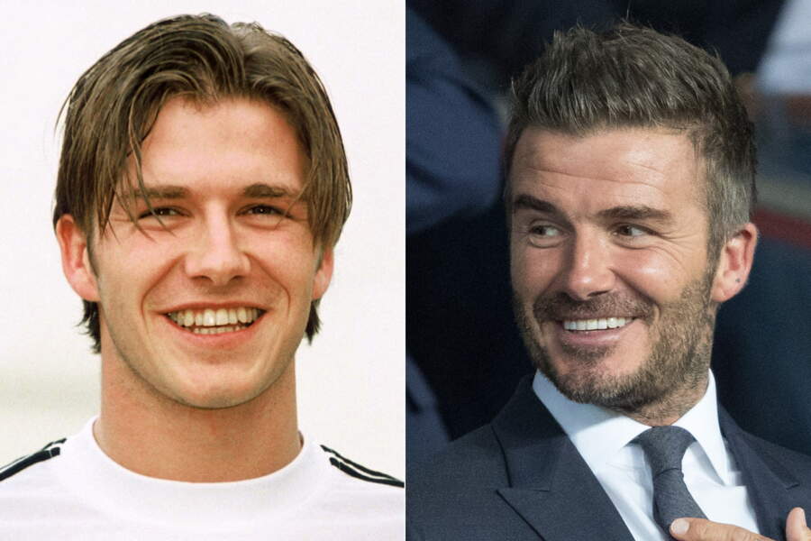 Avant/après : ces stars qui ont refait leurs dents - Femme Actuelle