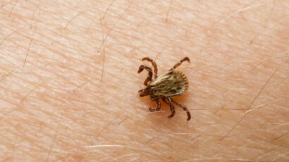 Poux du pubis : transmission, cause, symptômes et comment les ...