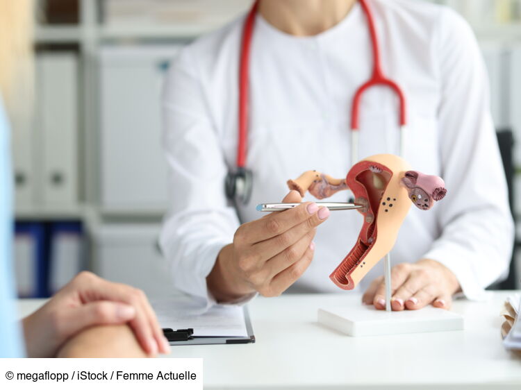 Quand faut-il consulter un gynécologue ? Un spécialiste répond : Femme ...
