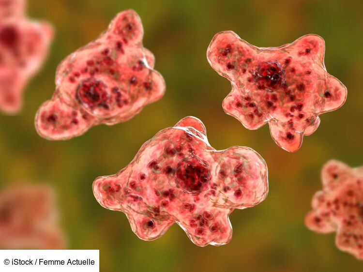 Amibe : définition, symptômes, comment éviter l'infection ? : Femme ...