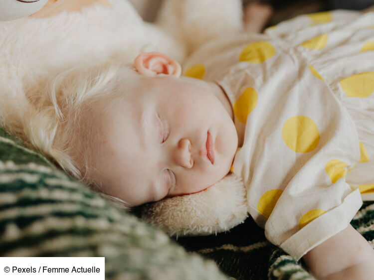 Traitement de la roséole : comment la soulager et quand consulter ...