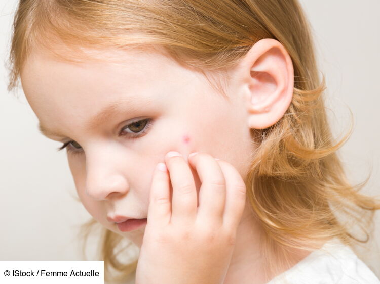 Éruption cutanée chez l’enfant : les différentes causes possibles ...