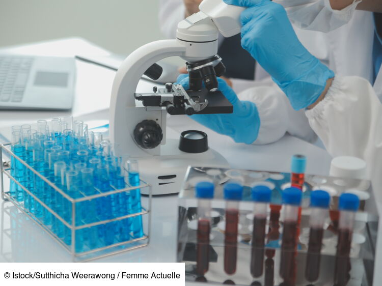 Biopsie du foie : durée, délai des résultats, déroulement : Femme ...