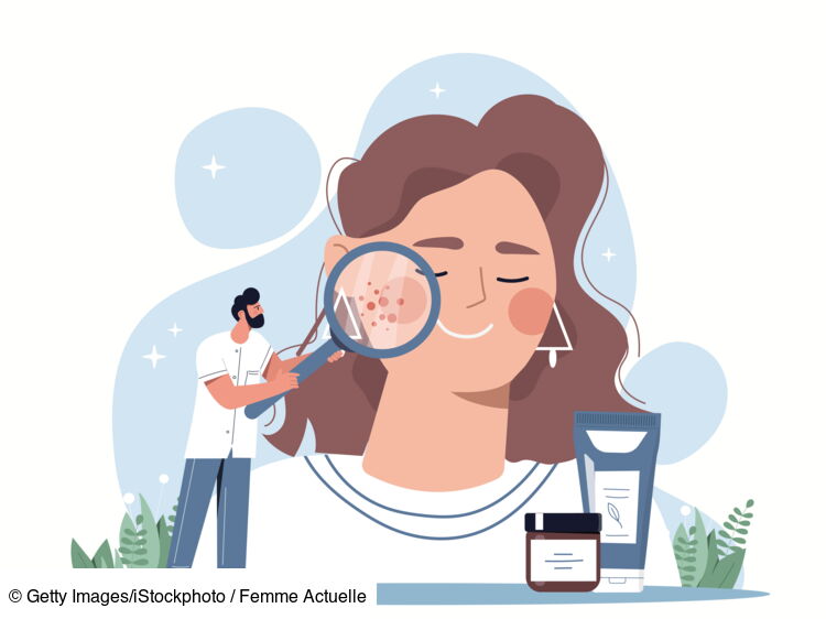 Rosacée : dans quel cas le laser est-il conseillé ? L'avis d'une ...