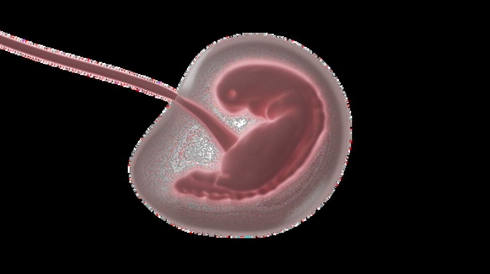 Embryon : définition, différence avec le foetus, développement : Femme ...