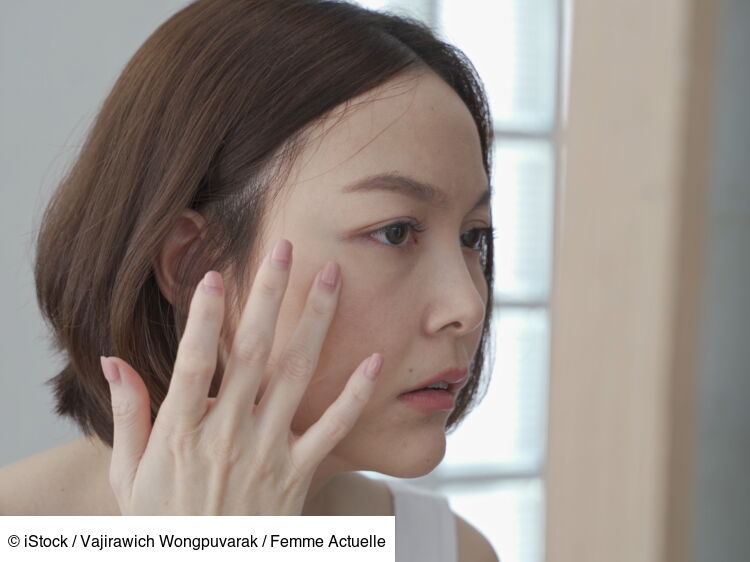 Plaque rouge sur le visage : pourquoi apparaît-elle et comment atténuer ...