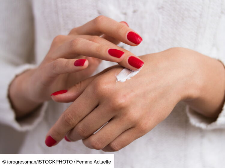 Mains sèches : les crèmes les plus efficaces pour les réparer l'hiver ...