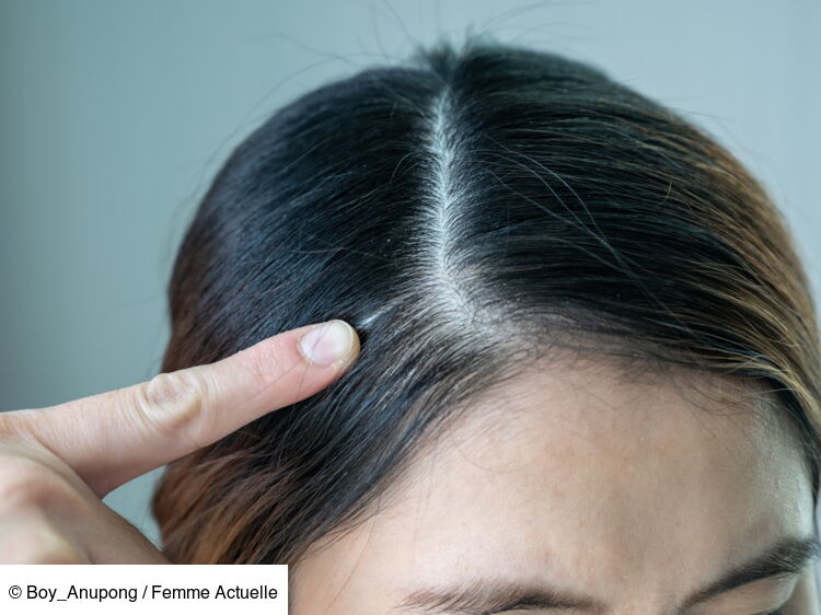 Comment ne plus avoir les cheveux gras ? 7 astuces simples et efficaces ...