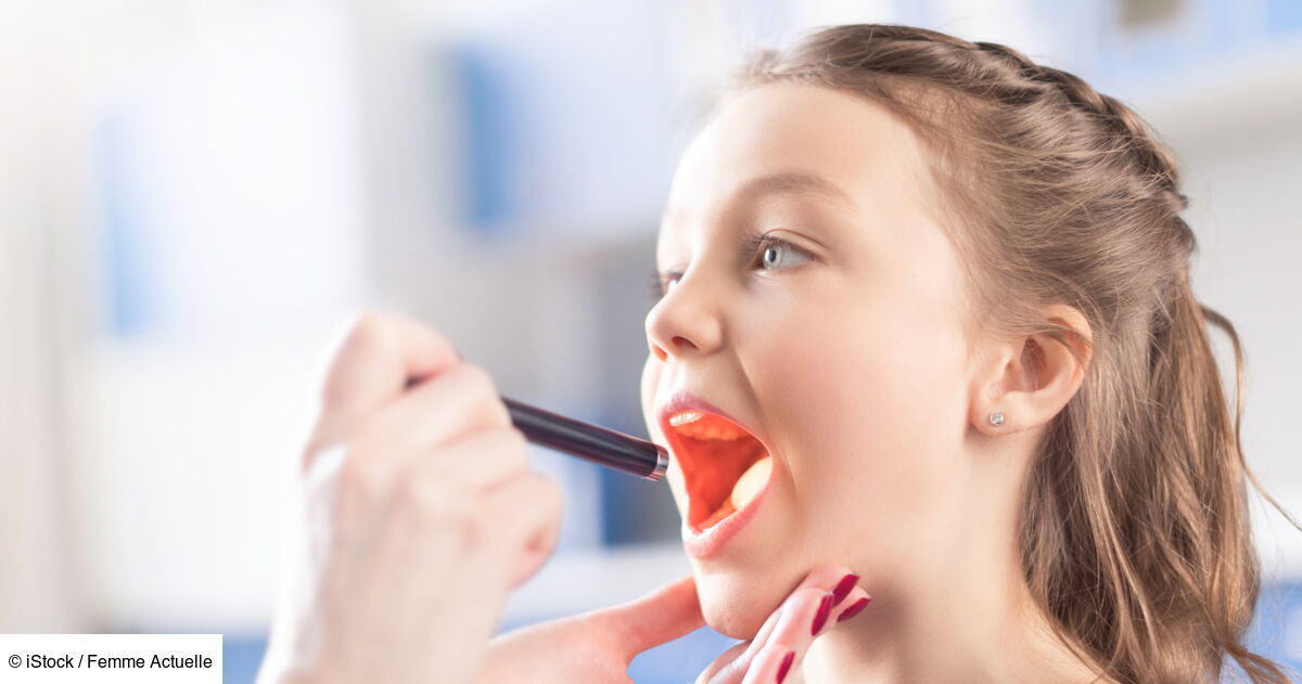 Uvulite : comment soigner une luette enflée ? : Femme Actuelle Le MAG