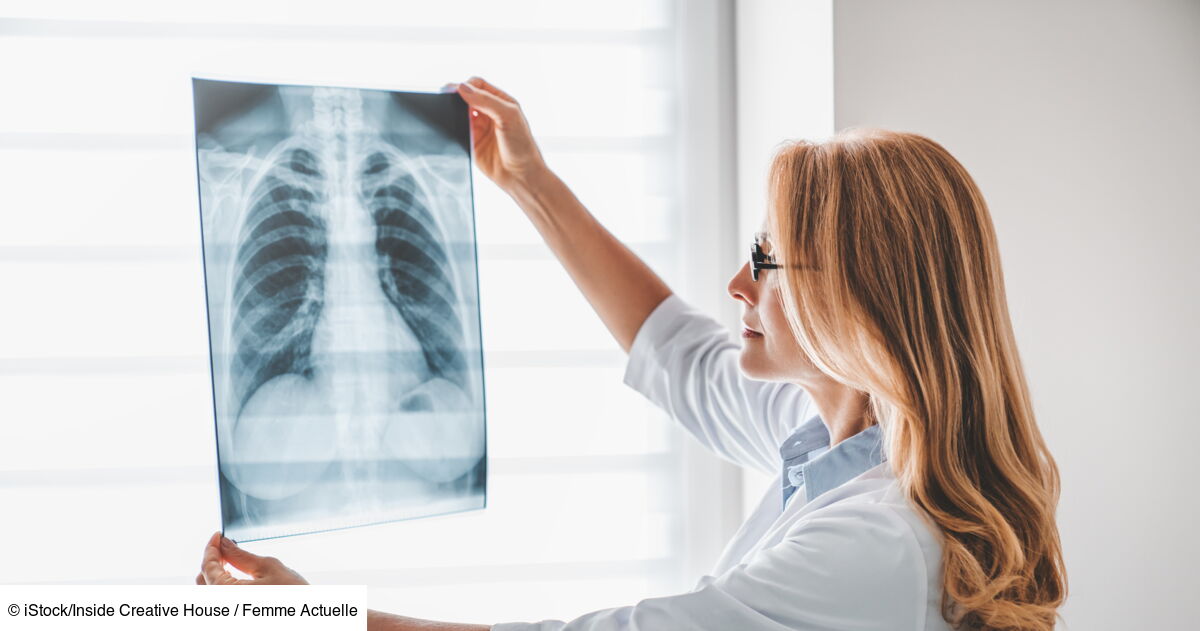 Légionellose : symptômes, mode de transmission, traitements : Femme ...