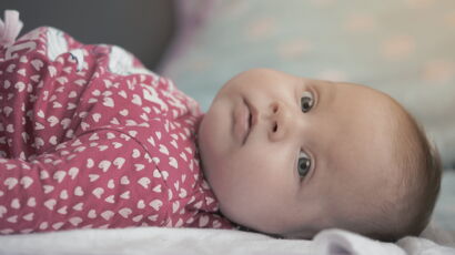 Intertrigo de bébé : causes, symptômes et traitements : Femme Actuelle ...