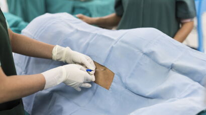 Cystocath urinaire : définition, utilité, pose et complications : Femme ...