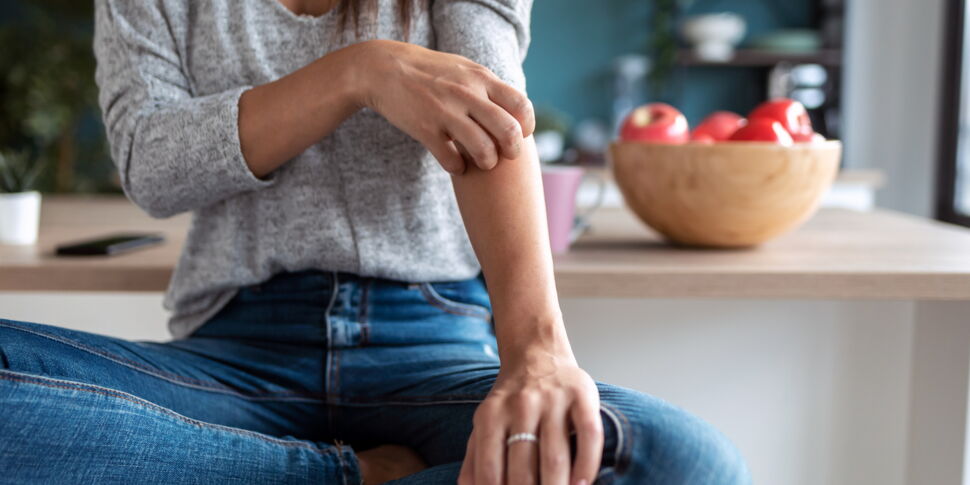 Gale : comment bien reconnaître les boutons de cette maladie de peau ...