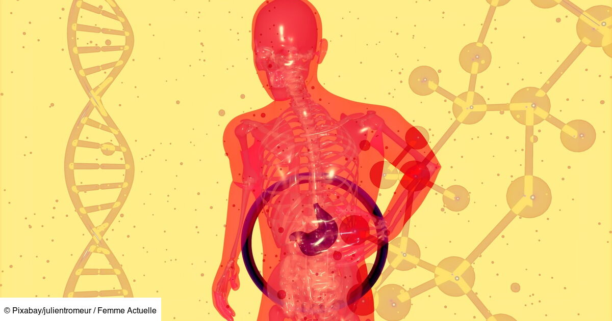 Endobrachyœsophage (EBO) : définition, causes, traitement de l’œsophage ...