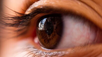 Neuropathie optique : traitement, symptômes, causes : Femme Actuelle Le MAG