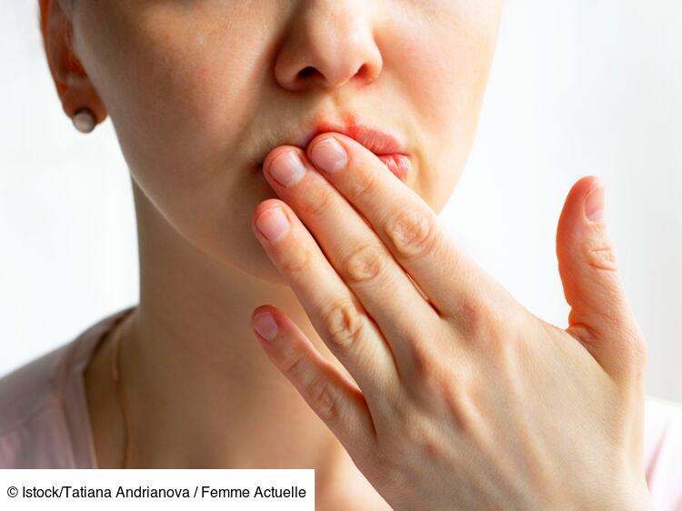 Candidose buccale : causes, symptômes, contagion, traitement : Femme ...