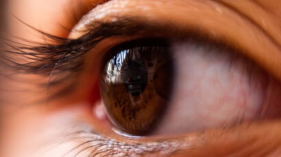 Périonyxis : causes, symptômes, traitement de cette inflammation du ...