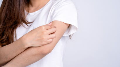 Urticaire cholinergique : causes, symptômes, traitement : Femme ...