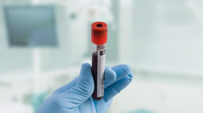 Macrocytose : causes, risques et traitements : Femme Actuelle Le MAG