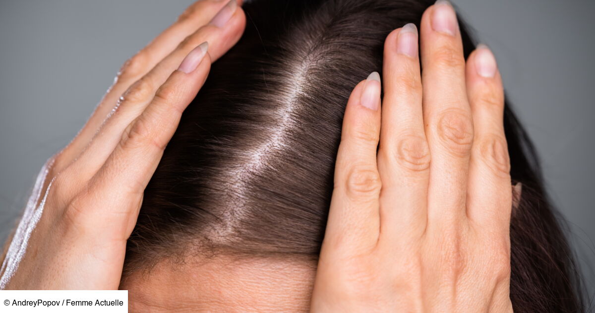 Cheveux fins, clairsemés : comment leur redonner de la force et du ...