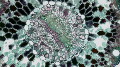 Gonalgie : quelles sont les causes possibles et les différents ...