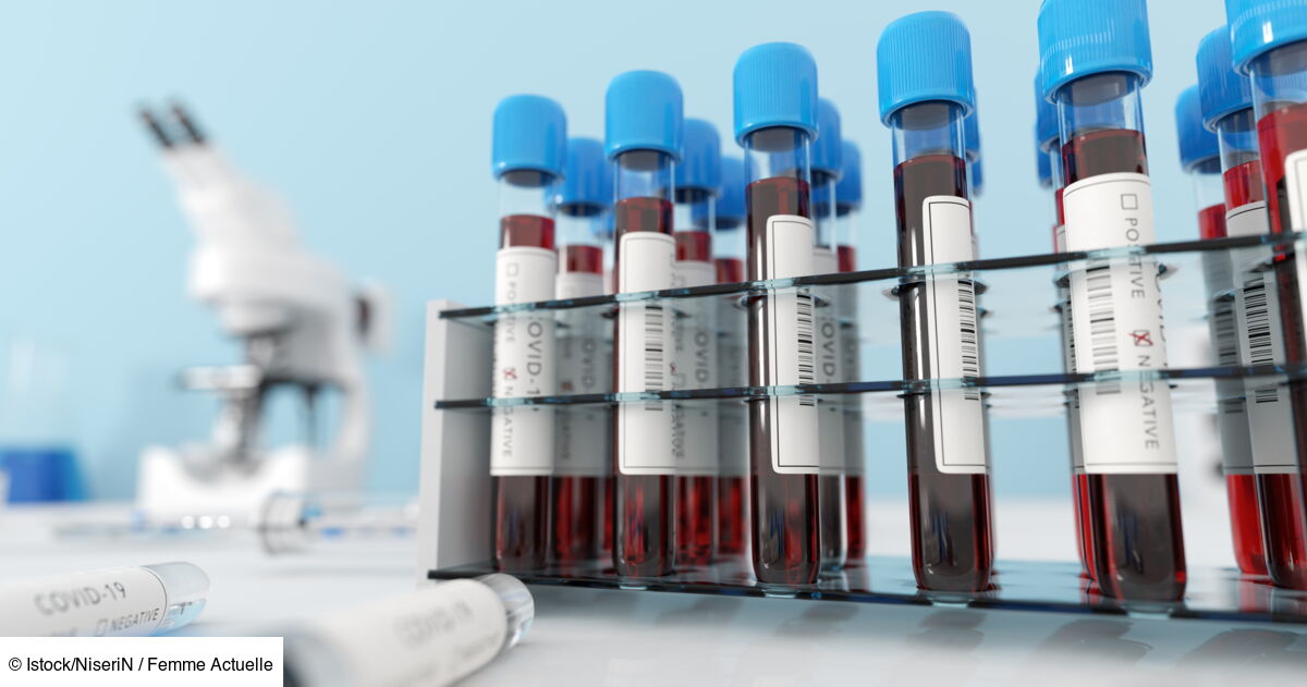 Urée : quel est le taux normal et comment lire une prise de sang ...