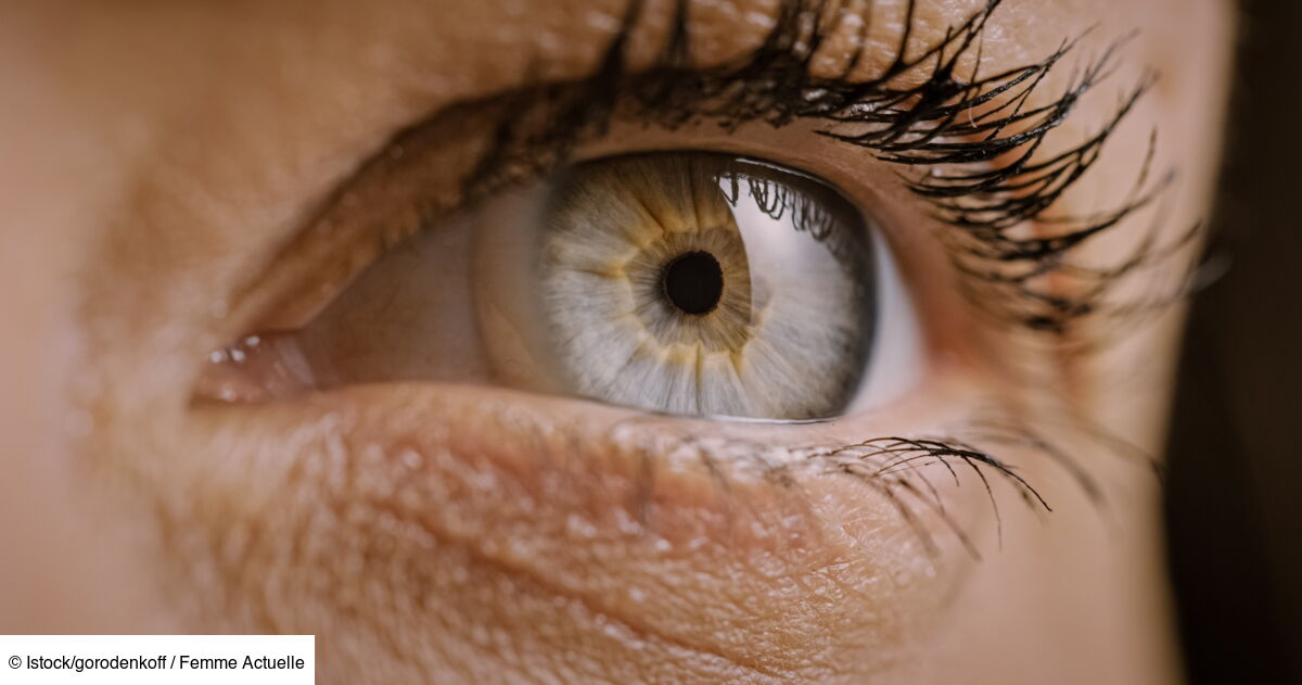 Tache dans l'œil : quelles sont les causes de ce trouble de la vision ...