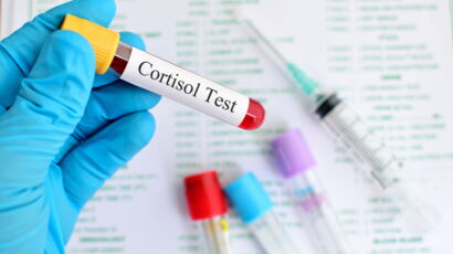 Leucocytes bas ou élevés - comment analyser les résultats et quelle ...