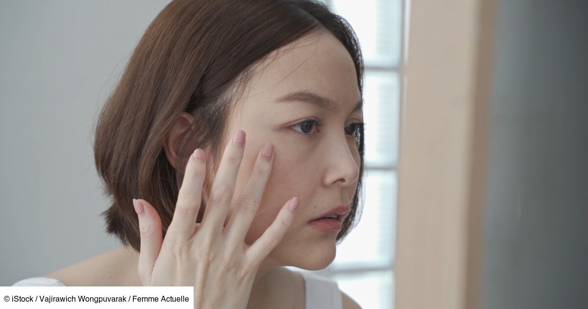 Plaque rouge sur le visage : pourquoi apparaît-elle et comment atténuer ...