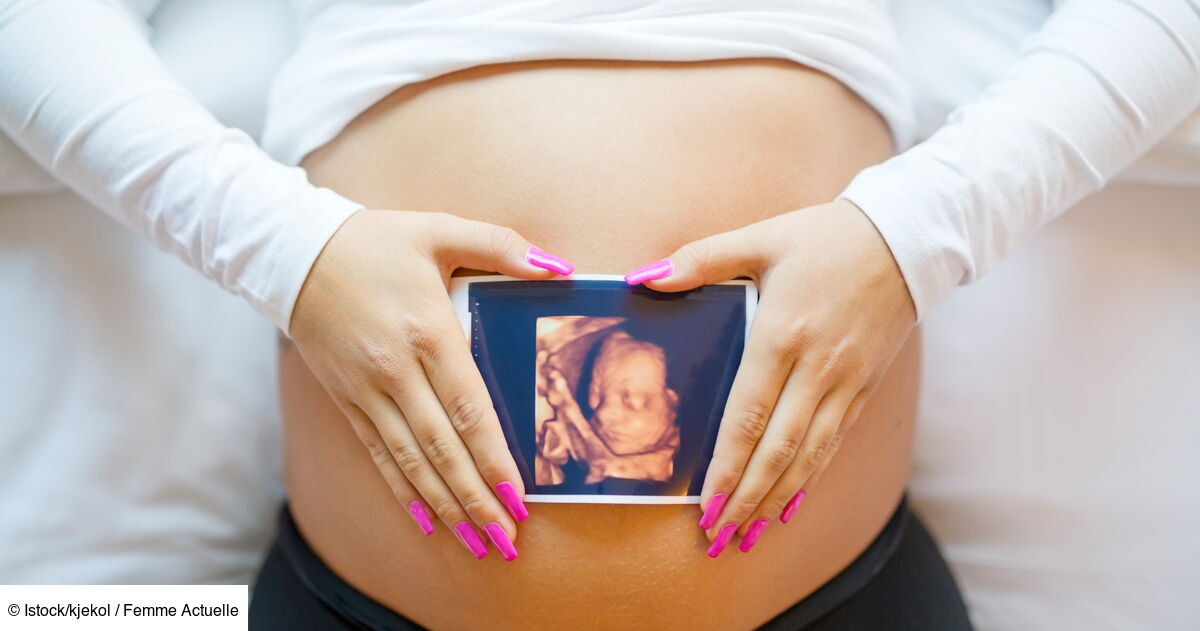 Échographie 3D : quand la faire et comment elle se déroule : Femme Actuelle Le MAG