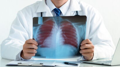 Cancer de la gencive : symptômes, diagnostic, traitements : Femme ...