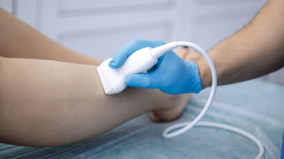 Phlébite superficielle : les meilleurs traitements pour la soulager ...