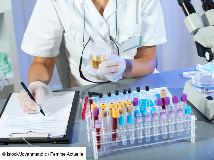 Hématies dans les urines : quelles sont les causes et faut-il s ...