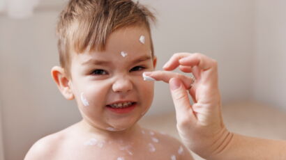 Pieds-mains-bouche : comment reconnaître ces boutons caractéristiques ...
