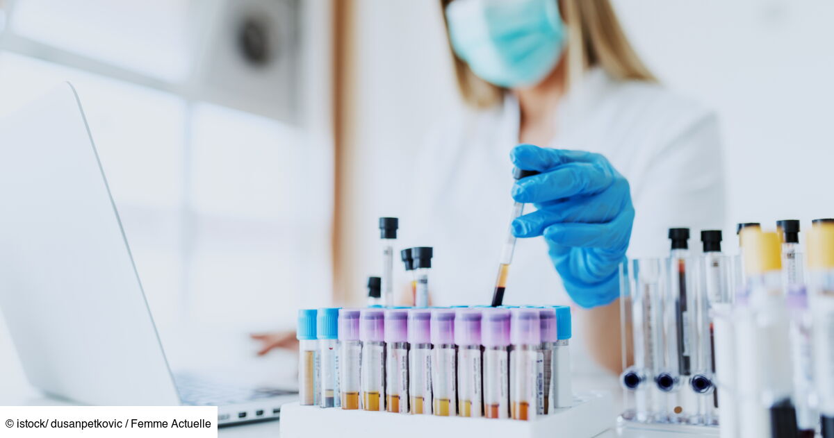 Dosage de l'urée : trop élevée ou trop basse, quelles sont les causes ...