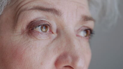 Yeux vairons : comment expliquer l’hétérochromie et quand faut-il ...