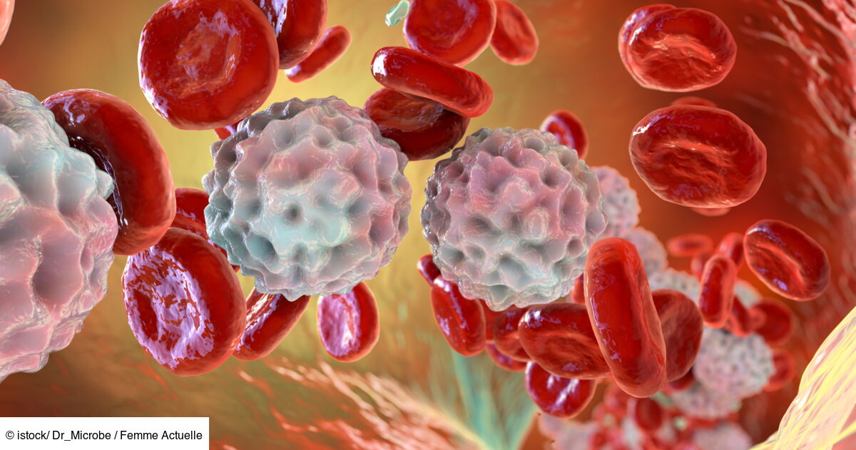 Taux de globules blancs trop élevés : qu’est-ce ce que ça signifie ...