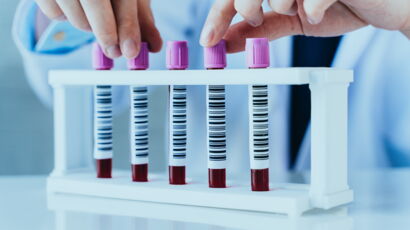 Hémoglobine basse : quelles causes et conséquences ? : Femme Actuelle ...