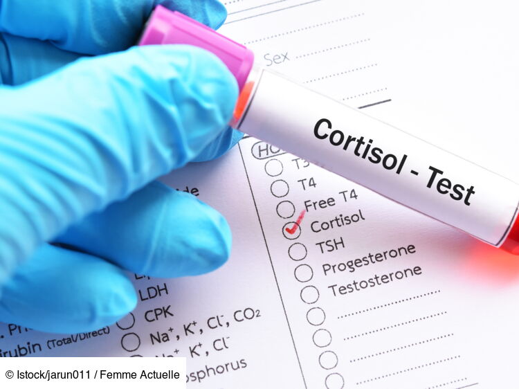 Qu'est-ce que l'hypercorticisme, ce trouble rare lié à un excès de ...