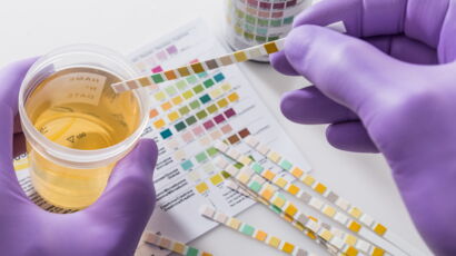 Urine trouble : les différentes causes possibles : Femme Actuelle Le MAG