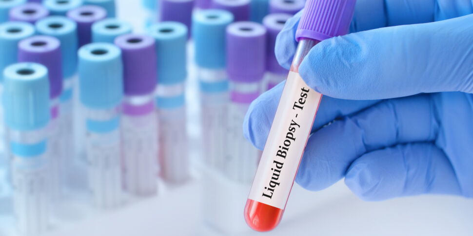 Cancer : qu'est-ce que la biopsie liquide et à qui s'adresse cet examen ...
