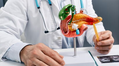Cancer du pancréas : quel est le facteur de risque le plus important ...