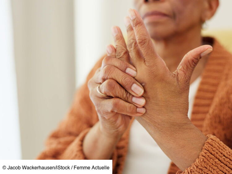Arthrose des doigts longs : quels sont les symptômes et traitements ...