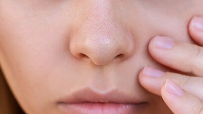Points noirs et filaments sébacés : une dermatologue nous dévoile les ...