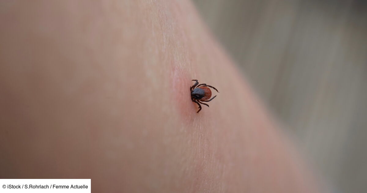 Piqué par une tique ? La seule technique efficace pour l'enlever ...
