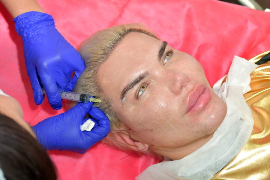Rodrigo Alves, surnommé le “Ken humain” : son évolution en images ...