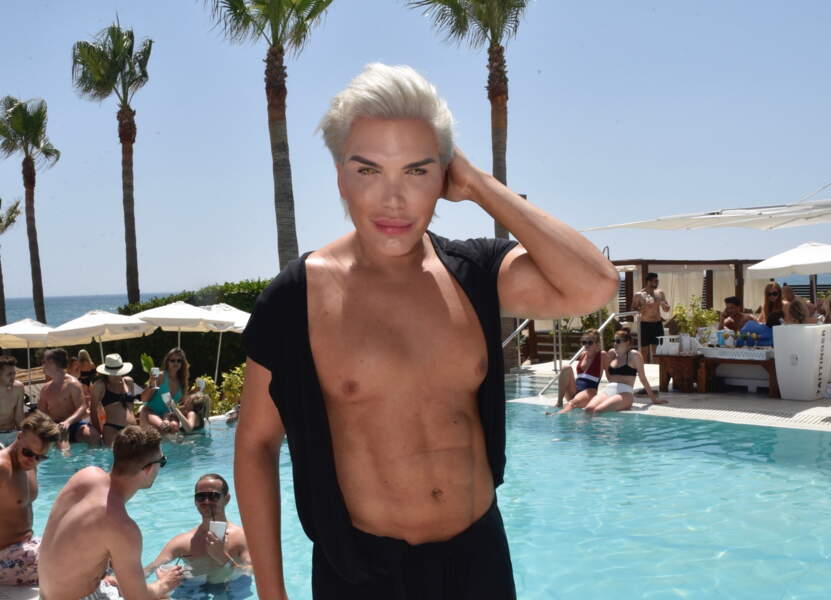 Rodrigo Alves, surnommé le “Ken humain” : son évolution en images - Femme Actuelle